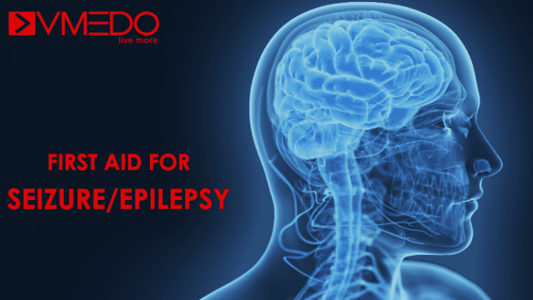 Know These First Aid Steps For Epilepsy/Seizures - VMEDO Blog