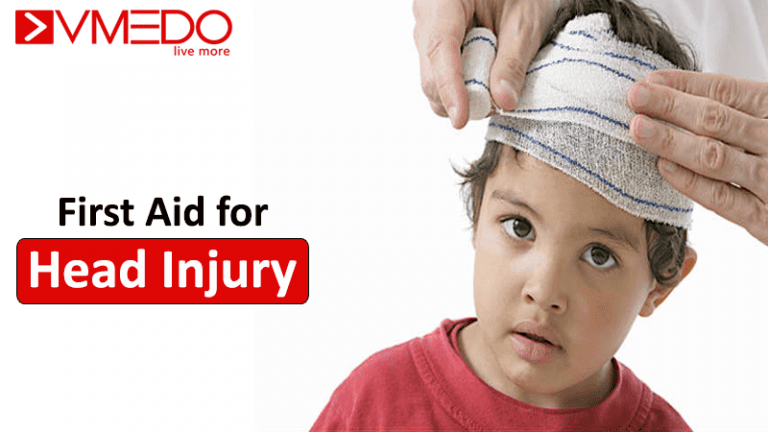 Know These First Aid Steps For Head Injury - VMEDO Blog