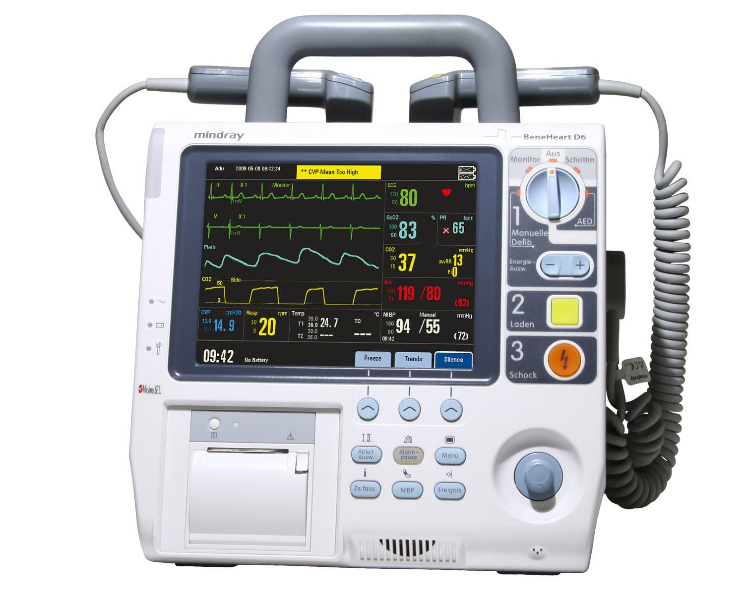 Top 10 Defibrillators Available at Best Price In India