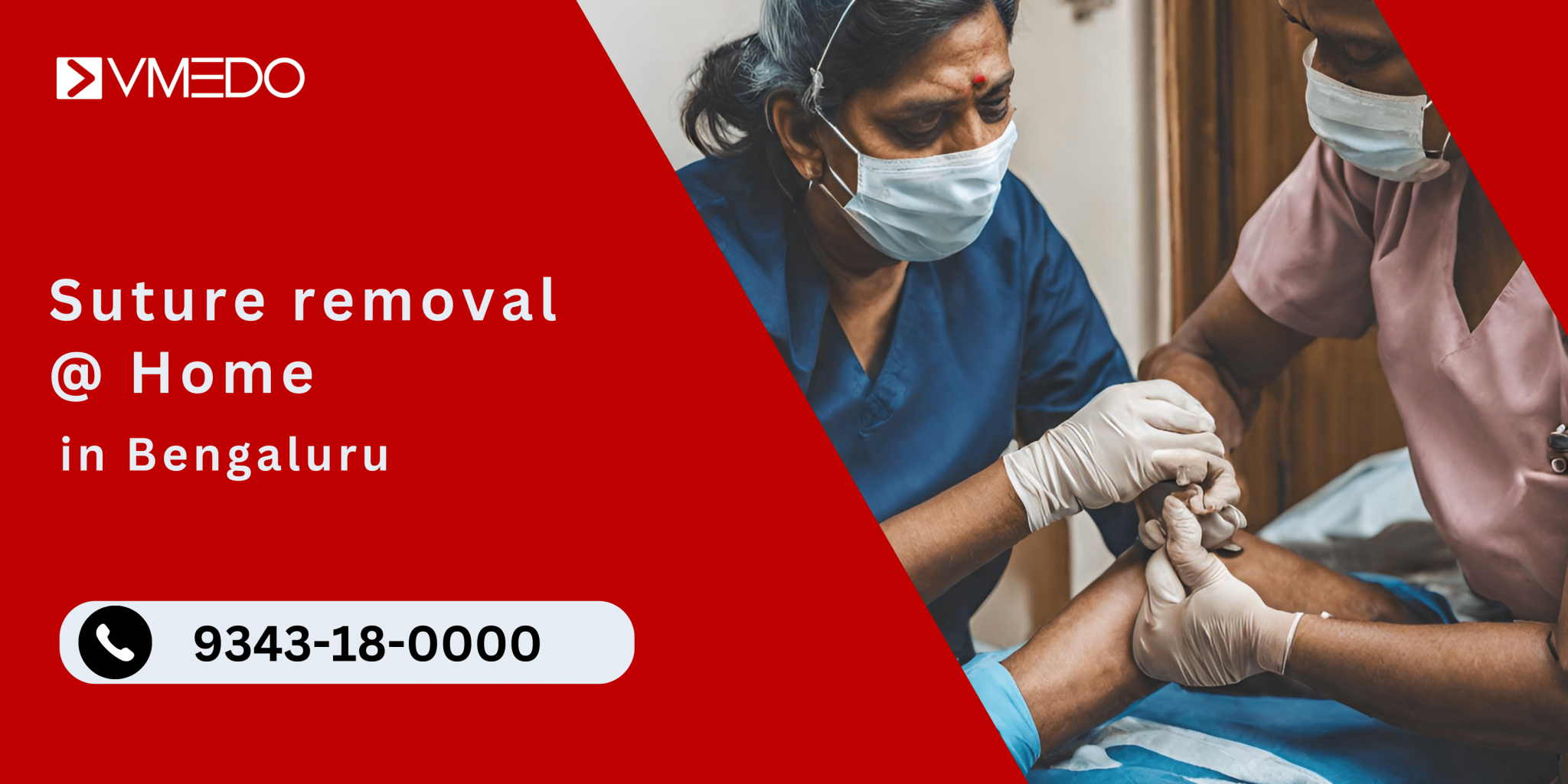 Suture removal at home in Bengaluru by a qualified Nurse - VMEDO Blog