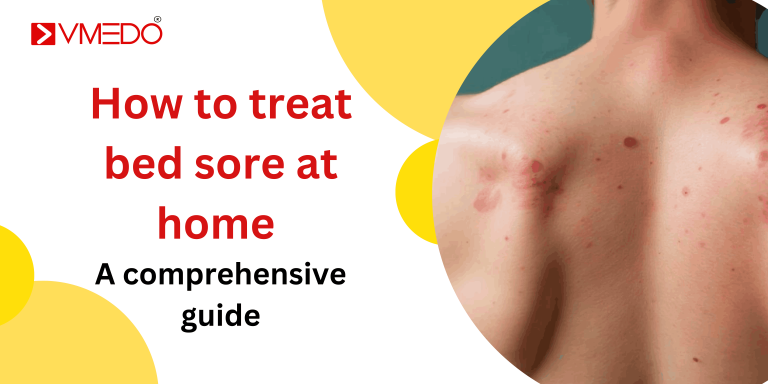 How to Treat Bed Sores at Home: A Comprehensive Guide - VMEDO Blog