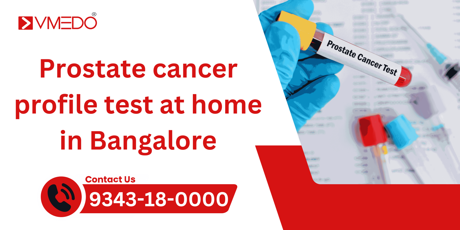 Prostate cancer profile test at home in Bangalore - 9343180000
