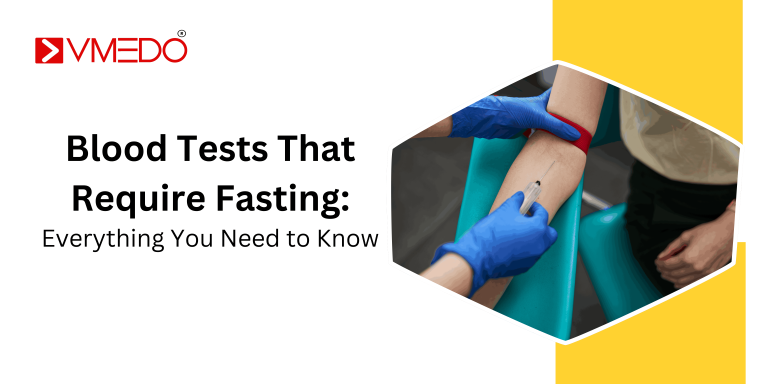 Blood Tests That Require Fasting: Everything You Need to Know - VMEDO Blog