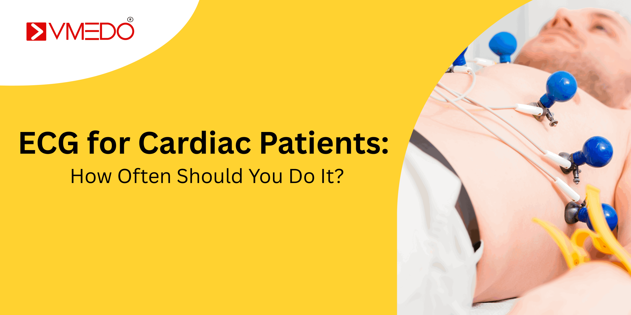 ECG for Cardiac Patients: How Often Should You Do It? - VMEDO Blog