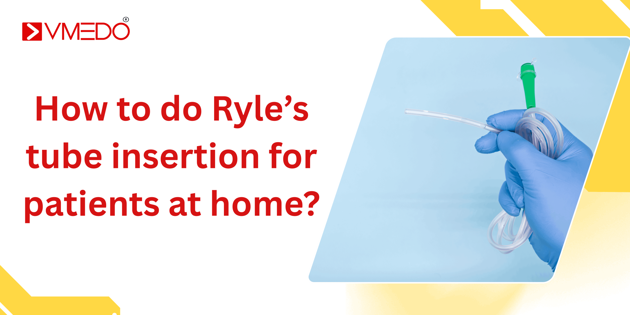 How to do Ryle’s tube insertion for patients at home? - VMEDO Blog