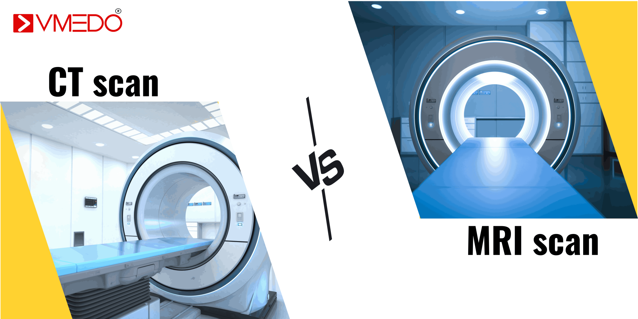 Difference between CT scan and MRI scan - VMEDO Blog