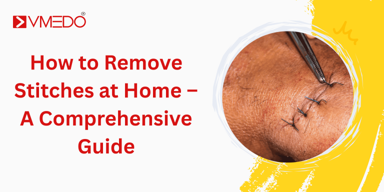How to Remove Stitches at Home – A Comprehensive Guide - VMEDO Blog